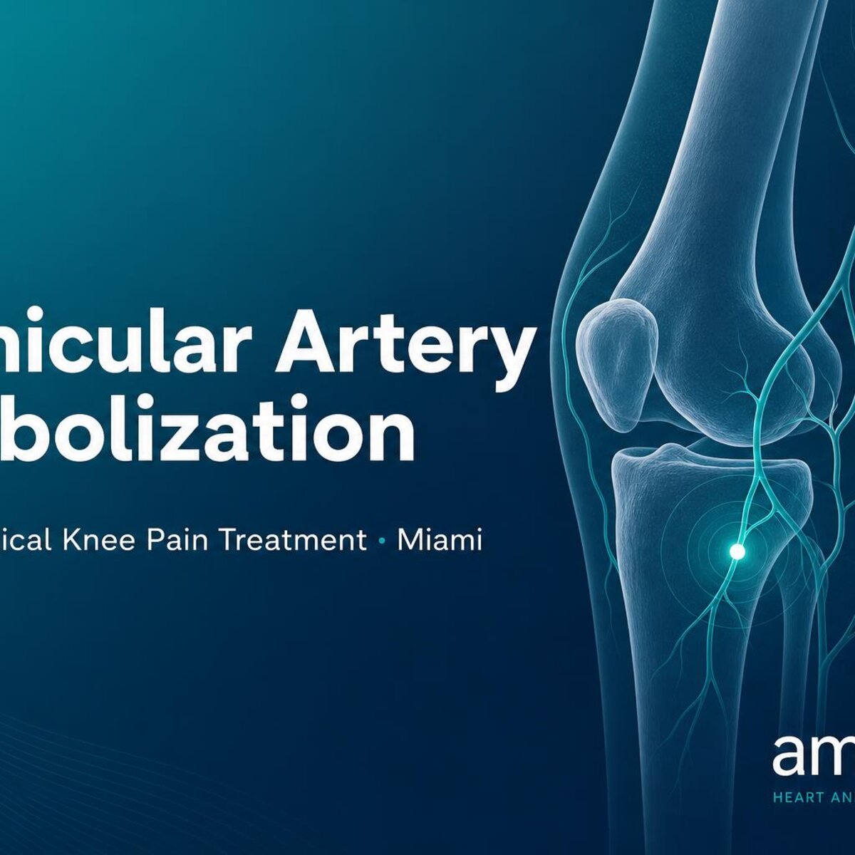 Genicular Artery Embolization (GAE) Miami | Non-Surgical Knee Pain ...